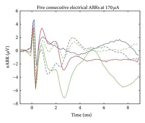 Electrically Evoked Auditory Brainstem Responses The First 005 Msec Download Scientific