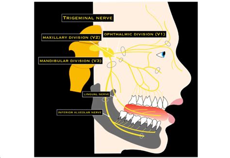 Trigeminal Nerve Pathway Diagram Themeroute Trigeminal Nerve Pathway Diagram Themeroute