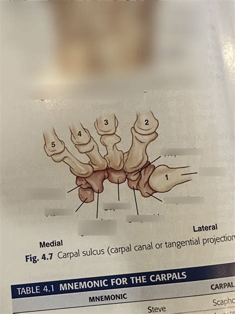 Carpal Sulcus Tangential Projection Diagram Quizlet