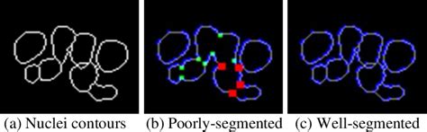 Bending Loss Regularized Network For Nuclei Segmentation In Histopathology Images