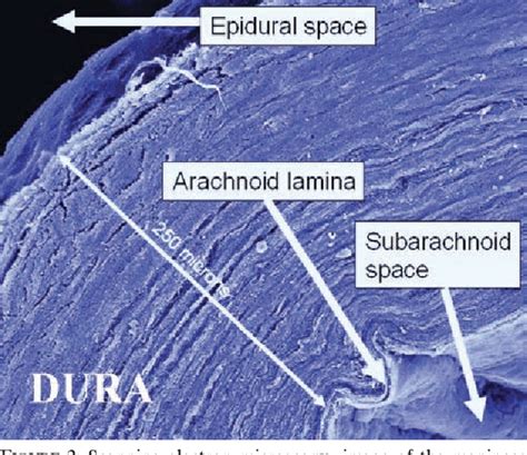 Figure 1 From An Anatomical Study Of The Intradural Space Semantic