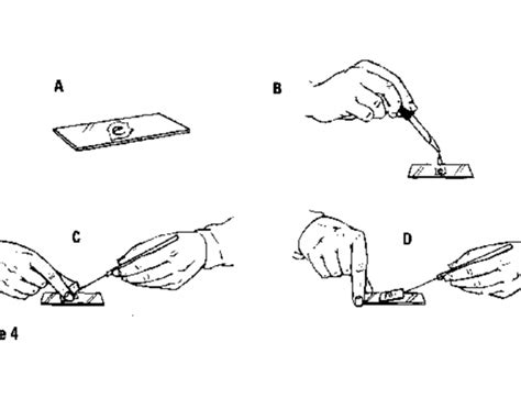 Fecal Direct Smear Procedure Quiz