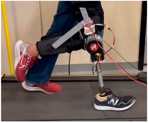 Force Moment Sensor For Prosthesis Structural Load Measurement