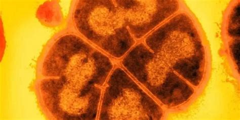 Extremophile Microbe Could Protect Humans From One Of The Most