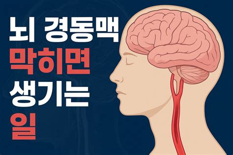 경동맥 협착 수술에 대한 진단