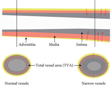 Schematic Diagram Of The Total Vessel Area Tva And The Eccentricity Download Scientific