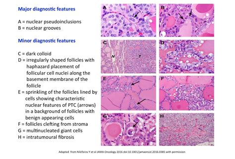 Thy3a Pvptc Niftp Rcpath Document