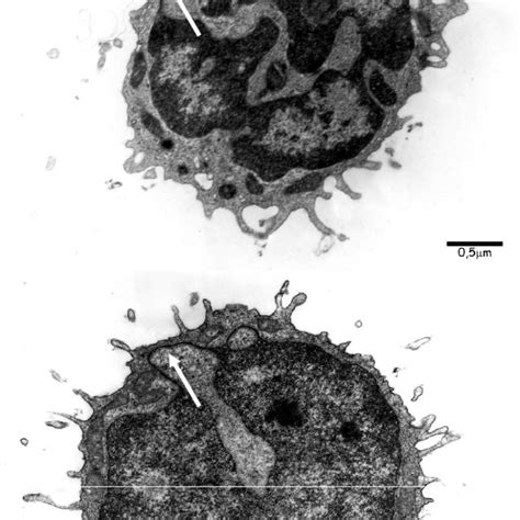 Characteristic Morphology Of B 1b Cells Cells Were Characterized As Download Scientific