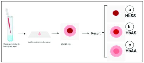 Paper Based Hemoglobin Solubility Test Created With Download Scientific Diagram