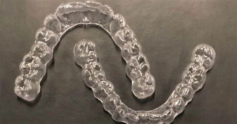 Thermoformed Vs 3d Printed Aligners