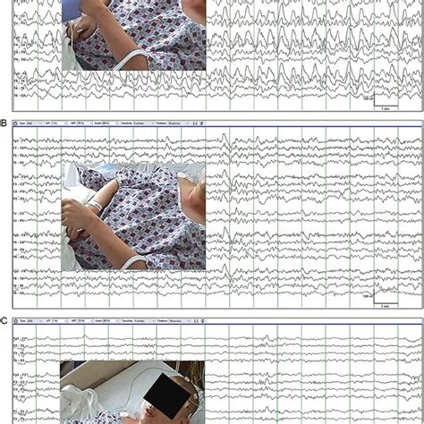 10 Algorithm For The Medical Treatment Of Catatonia Download Scientific Diagram