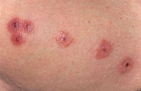 Python How To Extract Text Associated With Image From Pdf Stack Overflow