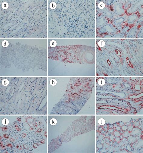 Histologic Distribution Of L Selectin Ligands In The Transplanted
