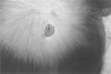 Case ACC On The Vertex Of The Scalp Download Scientific Diagram