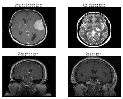 Diagnostics Free Full Text Exploring The Power Of Deep Learning Fine Tuned Vision