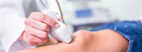 How Vascular Ultrasound Can Help With Varicose Veins Supreme Vascular And Interventional Clinic