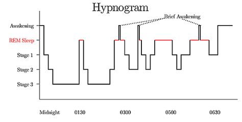 Hypnogram Updated Sound Sleep Health