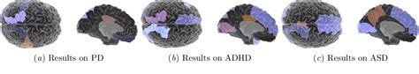 Figure 2 From Learning Temporal Higher Order Patterns To Detect Anomalous Brain Activity