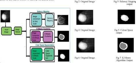 Figure From Breast Tumor Segmentation Using Image Segmentation Algorithms Semantic Scholar