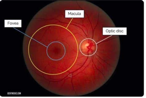 Funduscopic Appearances Of Retinal Pathologies Flashcards Quizlet