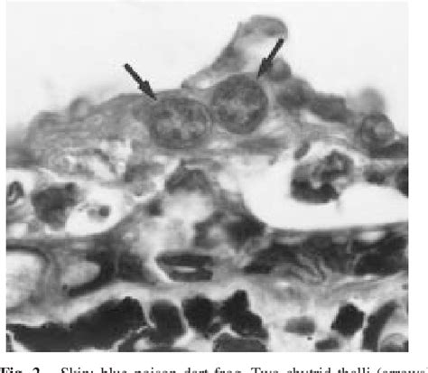 Figure 1 From Cutaneous Chytridiomycosis In Poison Dart Frogs