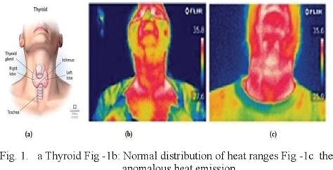 Figure 1 From An Appropriate Histogram Equalization Technique For Thermal Image Enhancement Of