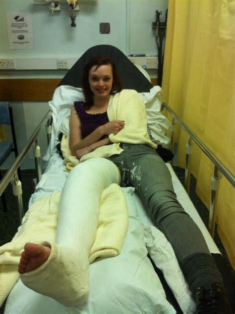 Castcasted Long Leg Cast Leg Cast It Cast