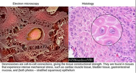 Sofia Pathology Remember Stratum Spinosum Of The Epidermis Desmosomes Are Found Throughout