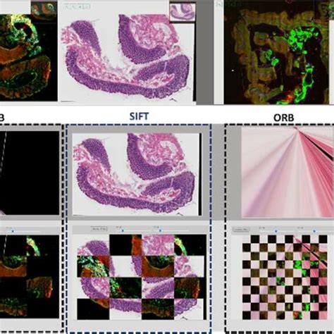 Comparison Between The Orb And Sift Registration Results Download Scientific Diagram