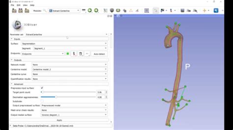 Documentationnightlytraining Slicer Wiki