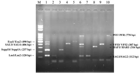 Figure 1 From Multiplex Pcr And A Chromogenic Dna Macroarray For The Detection Of Listeria