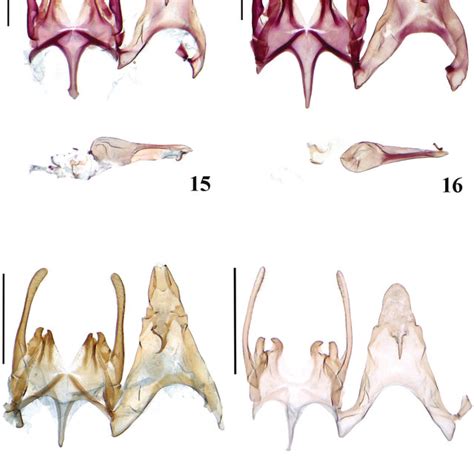 Male Genitalia Of Scrobipalpa Species 15S Triangulella Sp N PT Download Scientific Diagram