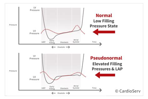 understanding the basics lv filling patterns cardioserv