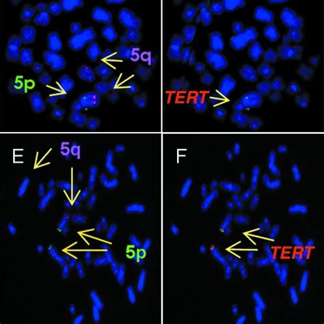 Fluorescent In Situ Hybridization Fish Of Metaphase Chromosomes From