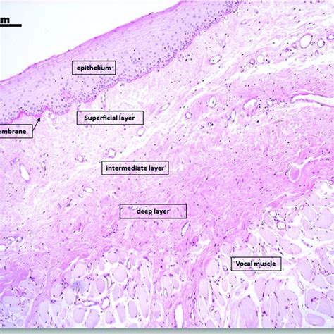 Human Vocal Fold Stratified Epithelium Delicate And Continuous Download Scientific Diagram