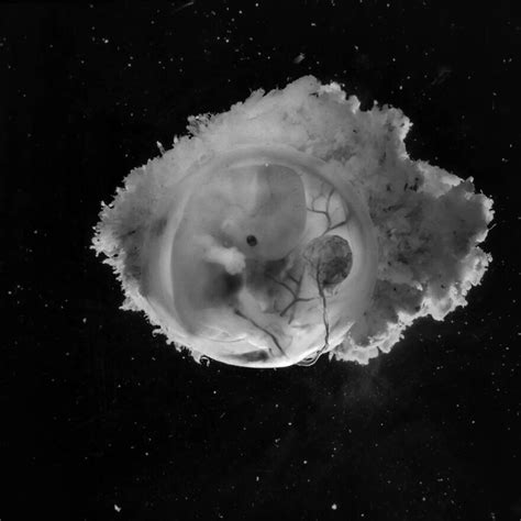 تصاویر شگفت انگیز از روند کامل شدن جنین عکس