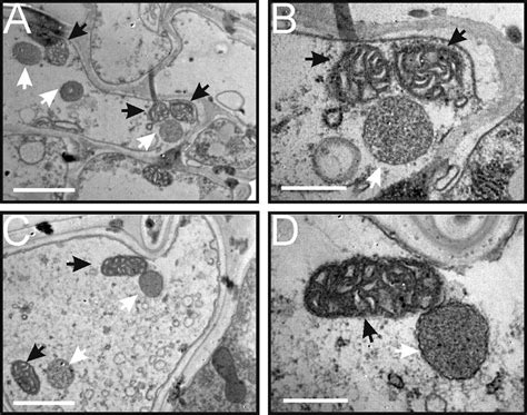 Mitochondrial Ultrastructure In Yta And Ytb Transmission Electron