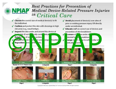 Mdpri Posters National Pressure Ulcer Advisory Panel