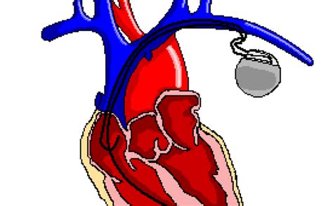 Pacemaker Components The Student Physiologist