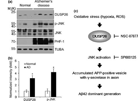 Dual Specificity Phosphatase 26 Dusp26 Expression Is Elevated In The