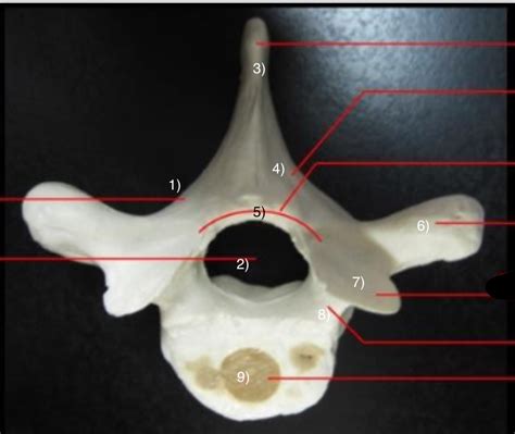 Typical Vertebrae Diagram Quizlet