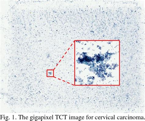 Figure 1 From Reversed Active Learning Based Atrous Densenet For