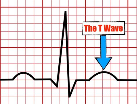 The T Wave — The Pr