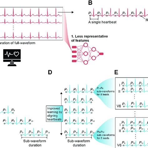 Electrocardiography Ecg Waveform Representations A Full Waveform Download Scientific