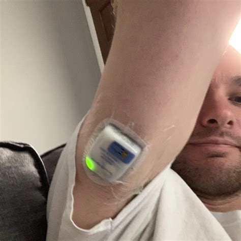 Can You Shower With Neulasta Patch At James Marts Blog