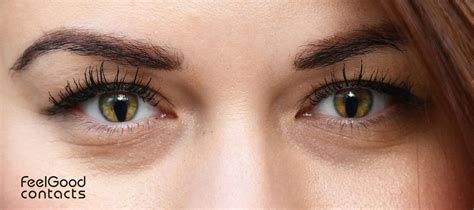 Coloboma Symptoms And Treatments Feel Good Contacts