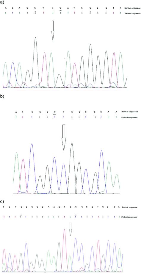 Electropherogram Of Mutations A C C A On Strand Leading To Download Scientific