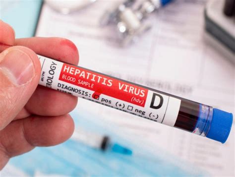 Гепатитын D вирусний халдвартай иргэдийн эмийн зардлыг улсын төсвөөс хариуцна Newmm Mn