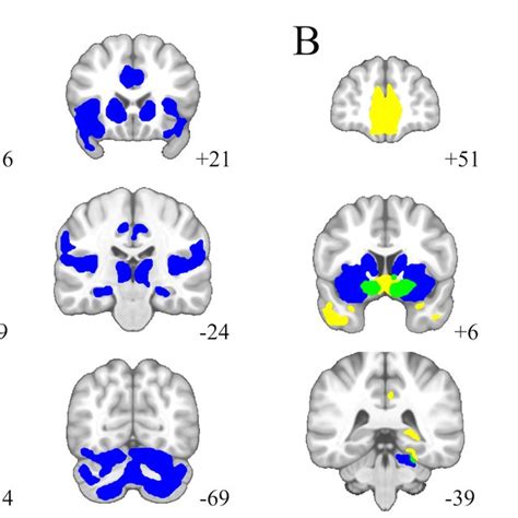 Anatomical And Functional Clusters Of The Basal Forebrain Top Download Scientific Diagram