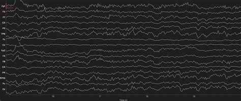 Filtering Eeg Data — Neural Data Science In Python